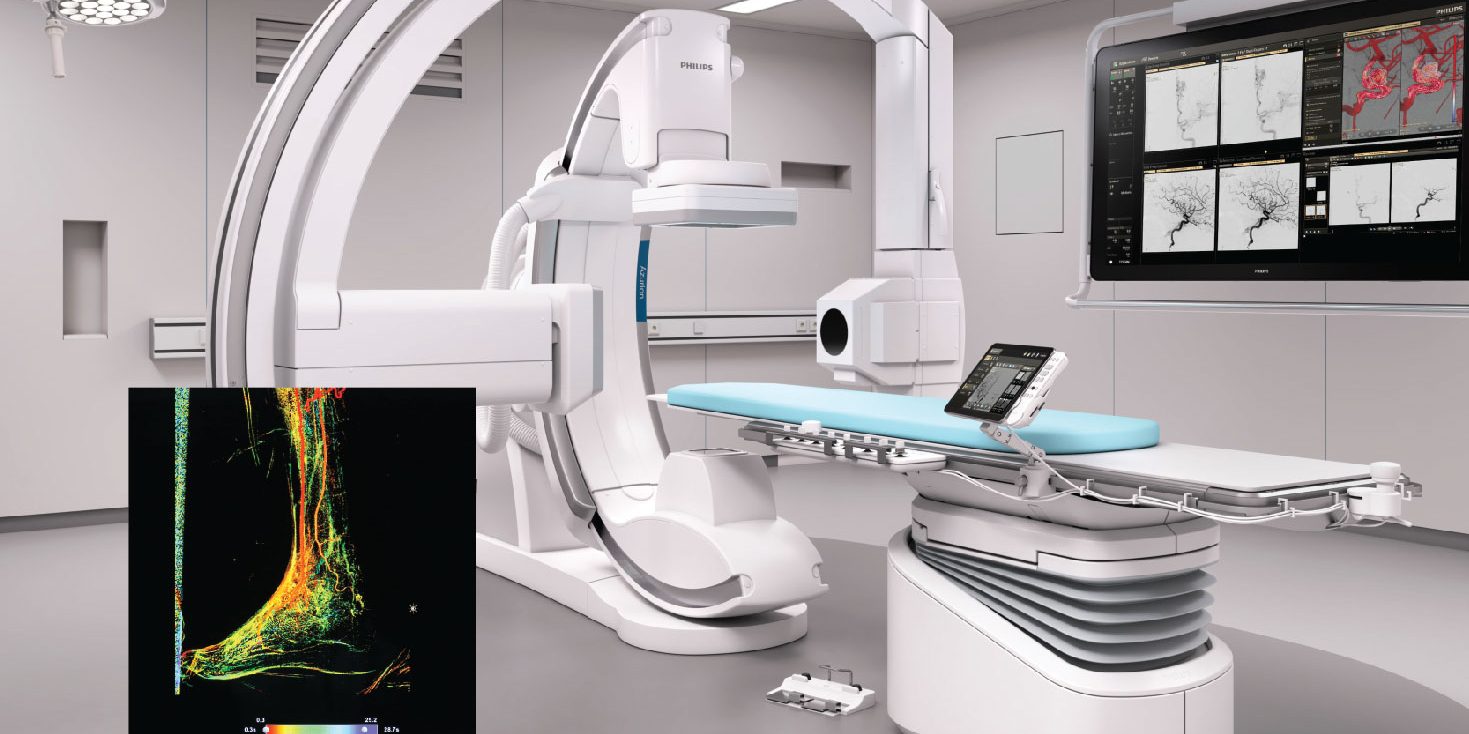 Peripheral Angioplasty Procedure at Durdans Hospital Offers Advantage ...